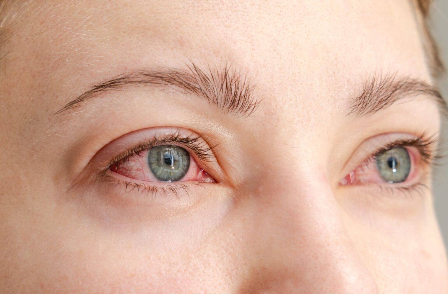 Why Do Allergies Only Affect One Eye? | Omaha, NE